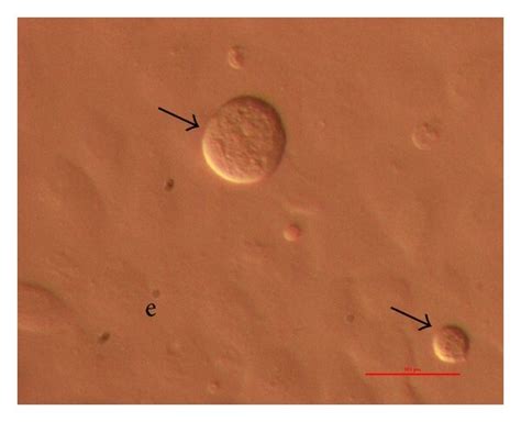 Primitive Oocyte Like Cells Arrows Developing In Ovarian Surface