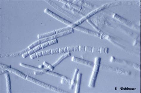 Geotrichum candidum microscopy