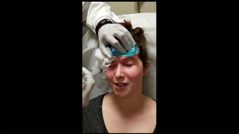 Inferior Orbital Nerve Block