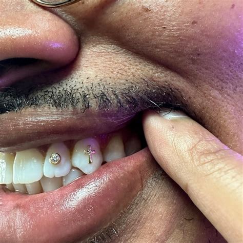 Tooth Gems 18k Diamond Bezel Etsy