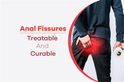 Anal Fissurestreatable And Curable By Laserpiles Medium