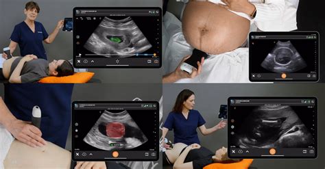 VIDEO SERIES Master Handheld Ultrasound Techniques For Prenatal Care