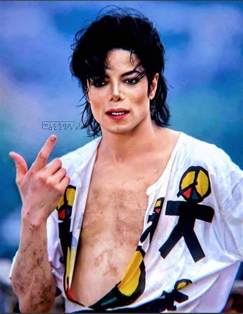 Vitiligo Michale Jackson A Detailed Picture Showing Michael S A Skin