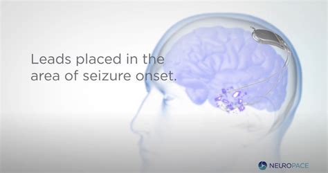 Peering Into The Mind Thought Police Or Crime Prevention Law