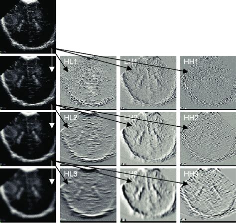 An Illustration Of The Non Decimated Wavelet Transform Left Column