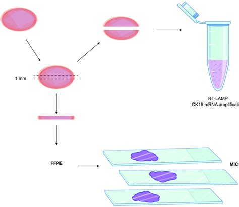 Formalin Fixation Principle At Michele Bodden Blog