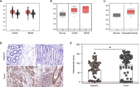 Usp14 通过靶向 Jnk 稳定促进结直肠癌进展cell Death And Disease X Mol