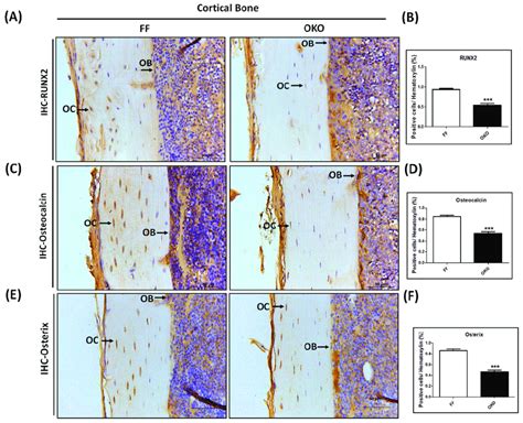 ddr1 deficiency significantly reduced osteogenesis related protein
