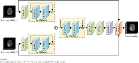 Figure 3 From Brain Tumor Segmentation In Multimodal Mri Via Pixel