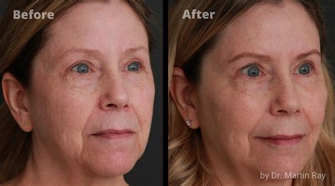 Patient Story Nancy Md Codes™ Emotional Attributes