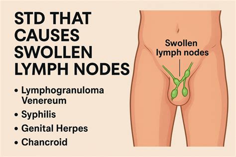 Std That Causes Swollen Lymph Nodes What You Should Know Sexual Hood