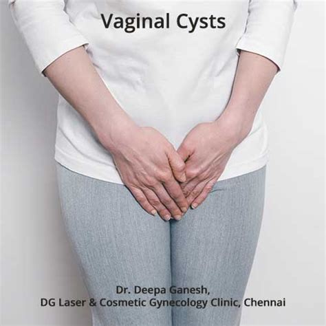 There Are Several Dg Laser And Cosmetic Gynecology Clinic