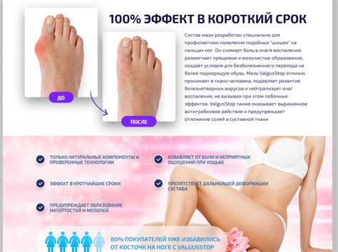 Лечение «косточек на ногах народными средствами Обсуждение на