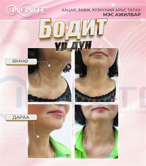 Infinite Clinic Арьс гоо сайхны мэс заслын эмнэлэг Home