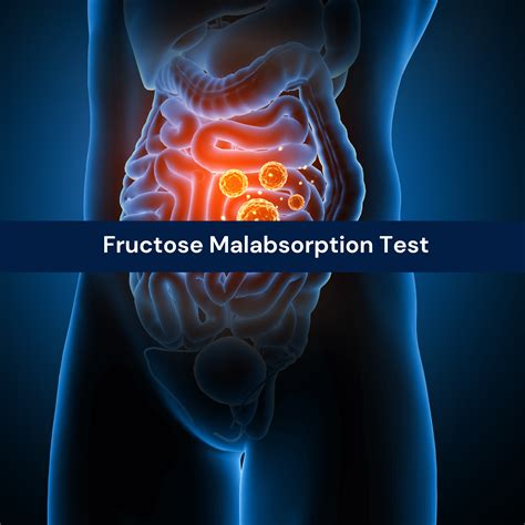 Fructose Malabsorption Test Christine Barnes Complex Case