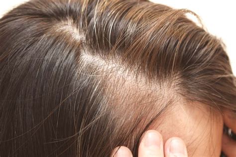 Danos Ao Cabelo 12 Práticas E Maus Cuidados Que Prejudicam Os Cabelos