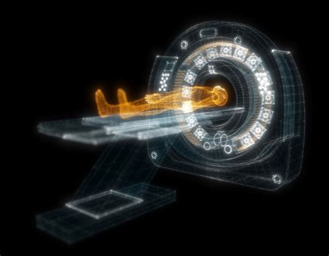 ¿qué Diferencias Hay Entre Una Resonancia Magnética Y Un Tac
