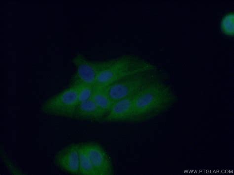 Hpgd Antibody 11035 1 Ap Proteintech
