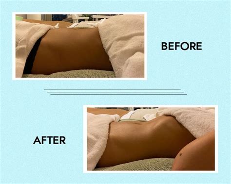 Brazilian Lymphatic Drainage Massages Have Become A Celebrity Fave—here