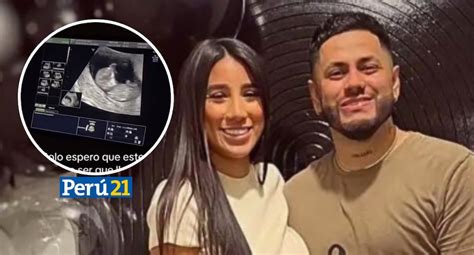 Samahara Lobatón Estaría Nuevamente En La Dulce Espera Según Ecografía