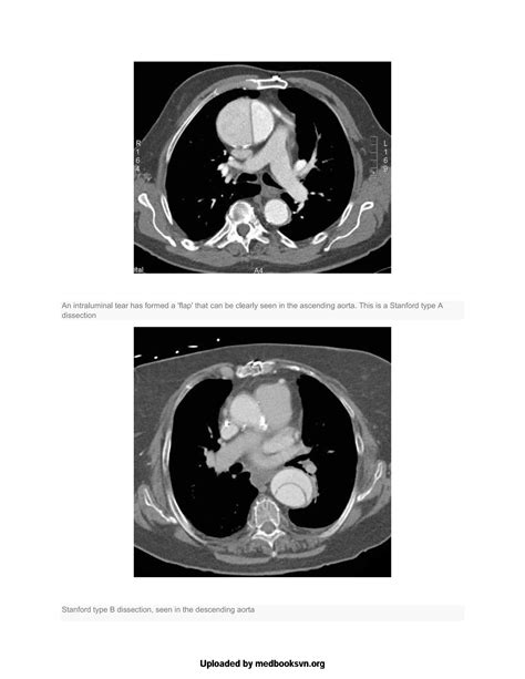 Passmedicine Notes With Key Points Passmedicine Pdf