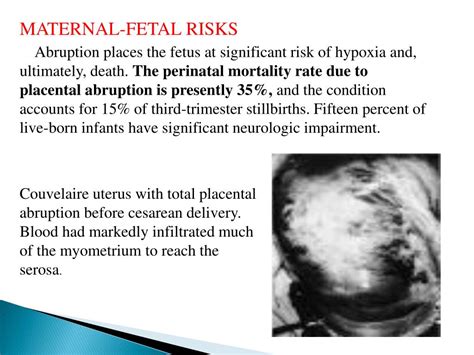 Ppt Abruptio Placentae Powerpoint Presentation Free Download Id2136352