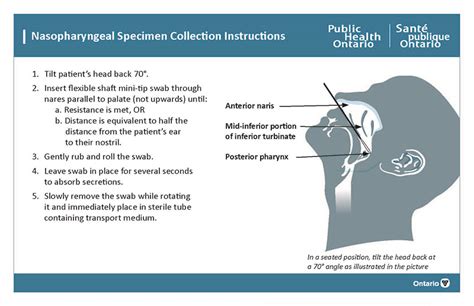 Nasopharyngeal Swab For Pertussis Testing Collection Laboraotry