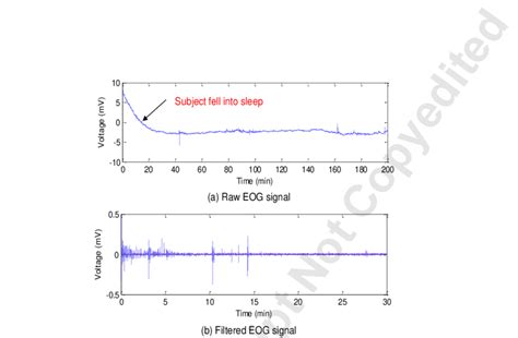 Raw Eog Signal A And Filtered Eog Signal B From Record 1 Signal