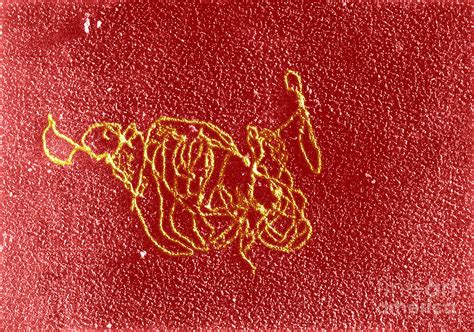 Dna And E Coli Rna Polymerase Reaction Photograph By Fernandez Moran