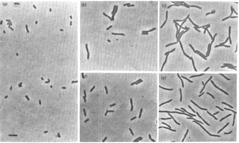 B Lactamase Activities Were Assayed After Addition Of Different