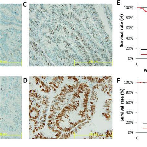 Immunohistochemical Staining Of Ezh2 In A Tissue Microarray Ezh2