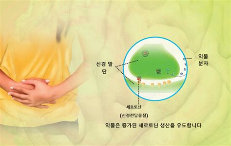 Health Condition Symptoms Causes Treatment And More