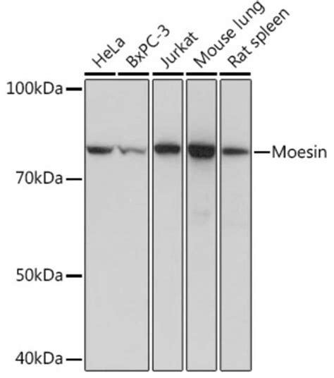 Moesin Recombinant Rabbit Monoclonal Antibody Arc1258 Invitrogen