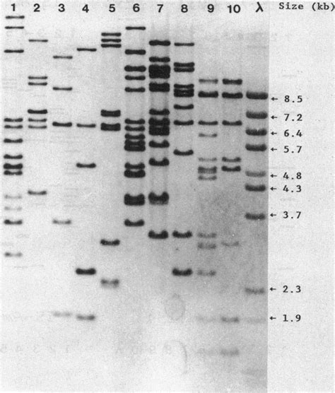 Southern Hybridization Of Ecori Digested Total Dnas From R Meliloti