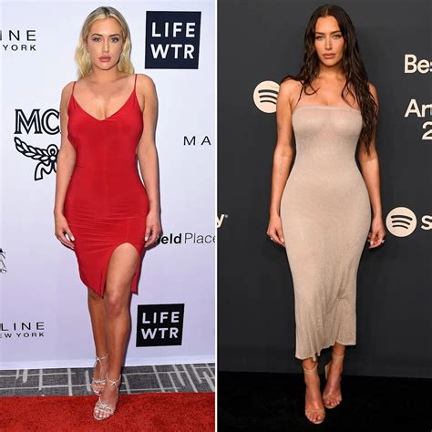 Has Stassie Karanikolaou Had Plastic Surgery Before And After Photos