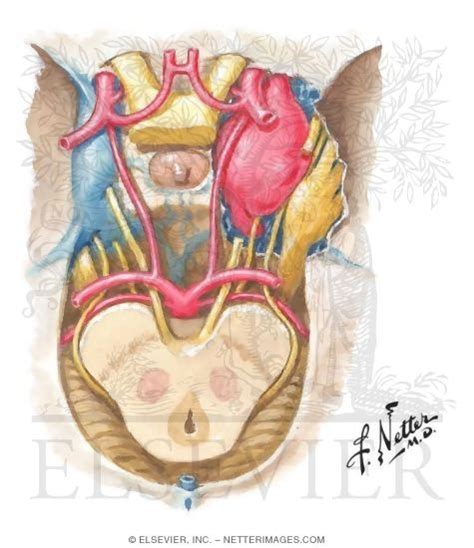 Posterior Communicating Artery Aneurysm Compressing Cranial Nerve Iii