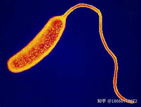 南美白对虾总是让弧菌趁虚而入这几点不清楚很容易卷土重来 知乎