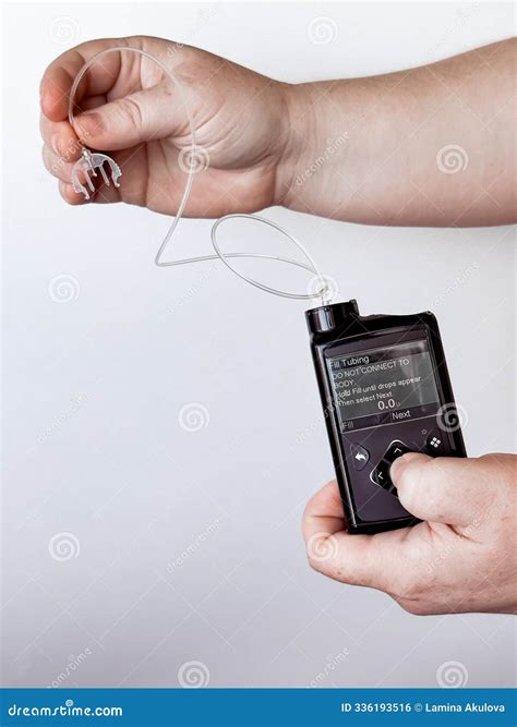 Modern Insulin Pump Device And Sensor Technology For Diabetes