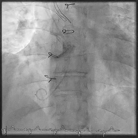 Wg Achd Chairperson On Linkedin Achd Guch Cardiotwitter