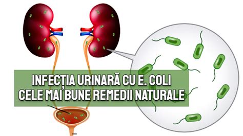 Infectia urinară cu E coli cele mai bune remedii naturale LaTAIFAS