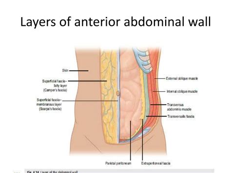 Ventral Hernia Inguinal Hernia Anterior Abdominal Wall Pptx