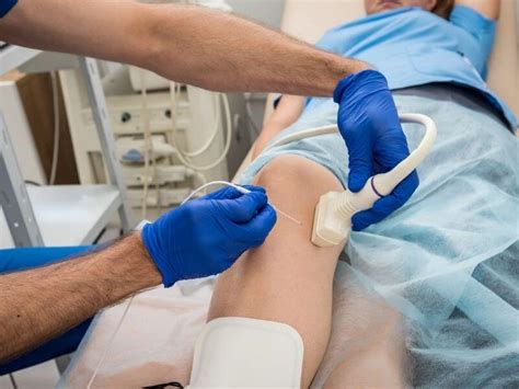 Differences Between Sclerotherapy Endovenous Ablation For Leg Vein Disease Vein Envy