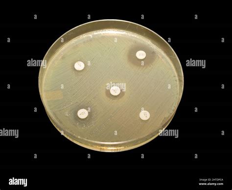 Closeup Shot Of The Antimicrobial Activity On The Metal Surface With