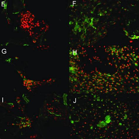 Poly Ɛ Caprolactonechitosan Pclch Foam Scaffolds 6 Mm Diameter Download Scientific