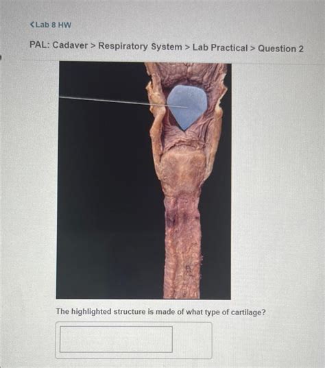 Solved Respiratory System Lab Practical Question The Chegg