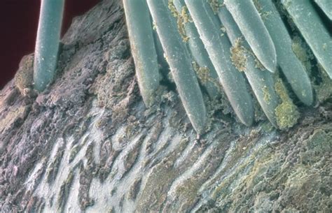 Plaque And Toothbrush Under Electron Microscope How To Dry Basil