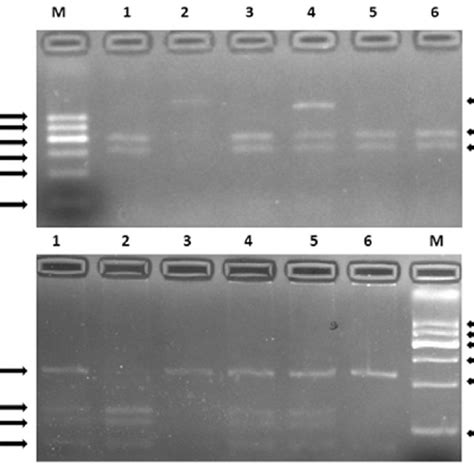 The Restriction Fragment Length Polymorphism Analysis To Determine The Download Scientific