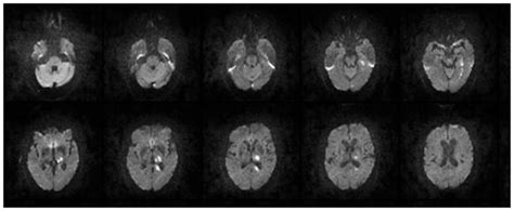 The Roles Of Occipitotemporal Cortex In Reading Spelling And Naming Pmc