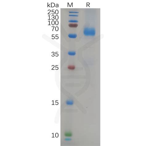 Buy Sars Cov 2 Delta Nucleocapsid C His Tag Nucleocapsid Recombinant