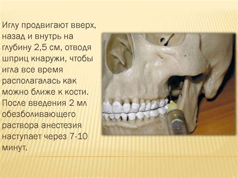 Туберальная анестезия - презентация онлайн